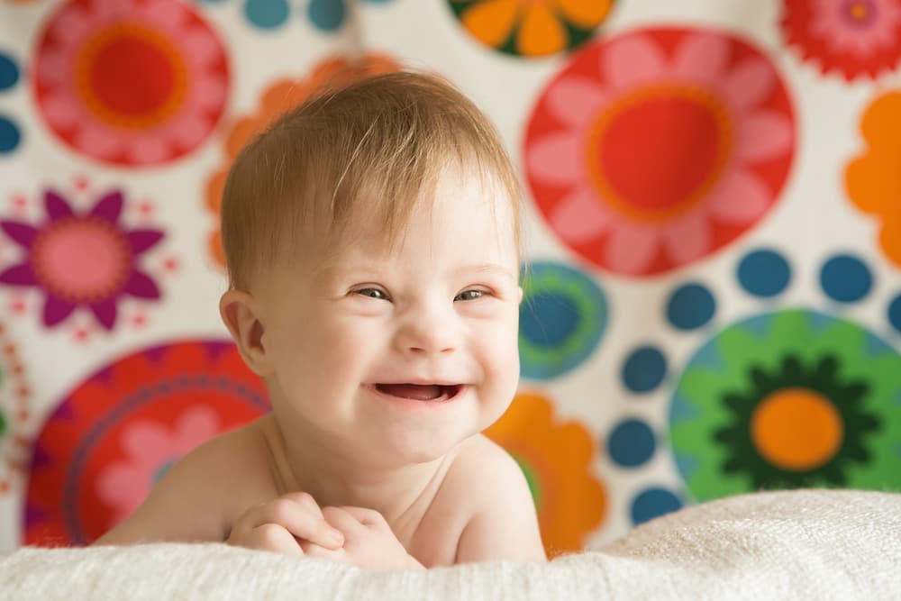 Bebê com síndrome de Down: principais sinais e cuidados após o ...