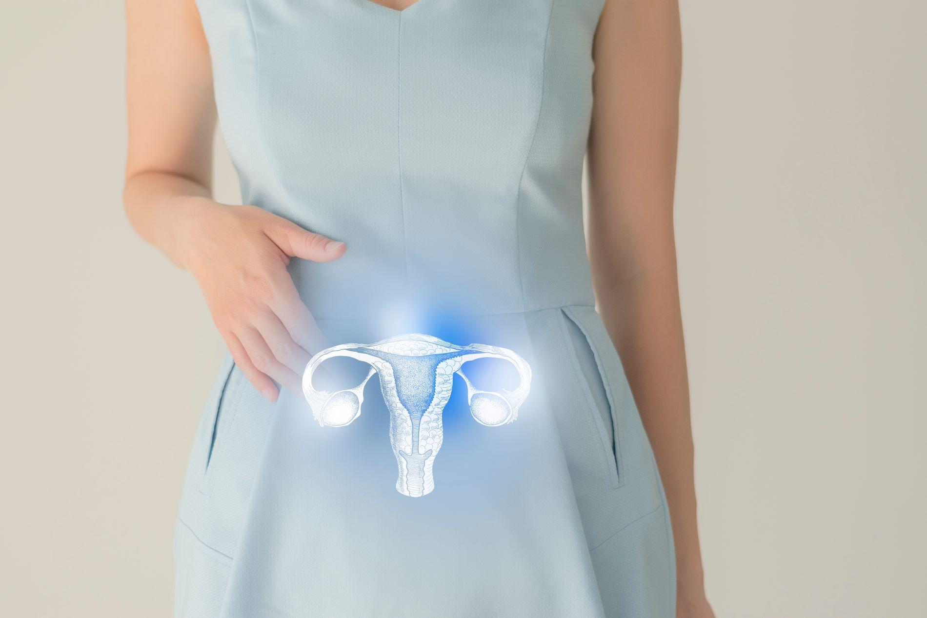 Cervicite: Inflamação do colo uterino deve ser tratada para evitar ...